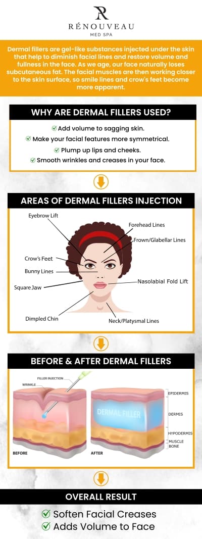 Dermal Fillers Treatment Near Me in Culver City Los Angeles, CA
