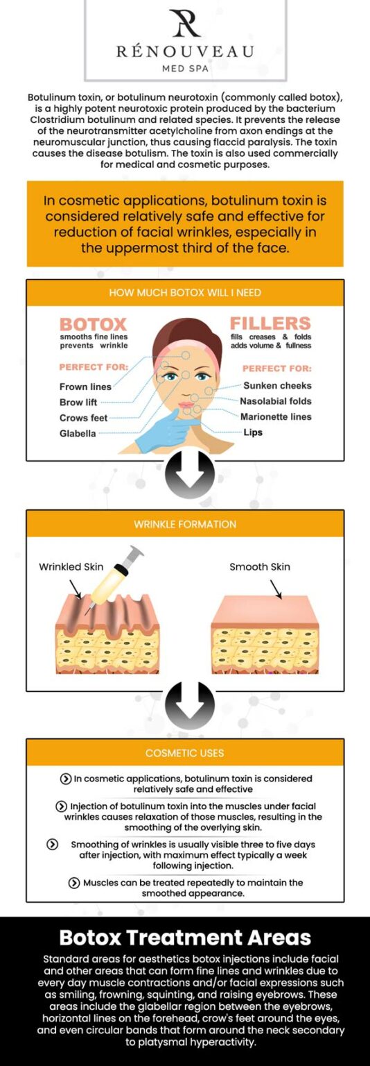 Botox Injections Near Me in Culver City Los Angeles, CA